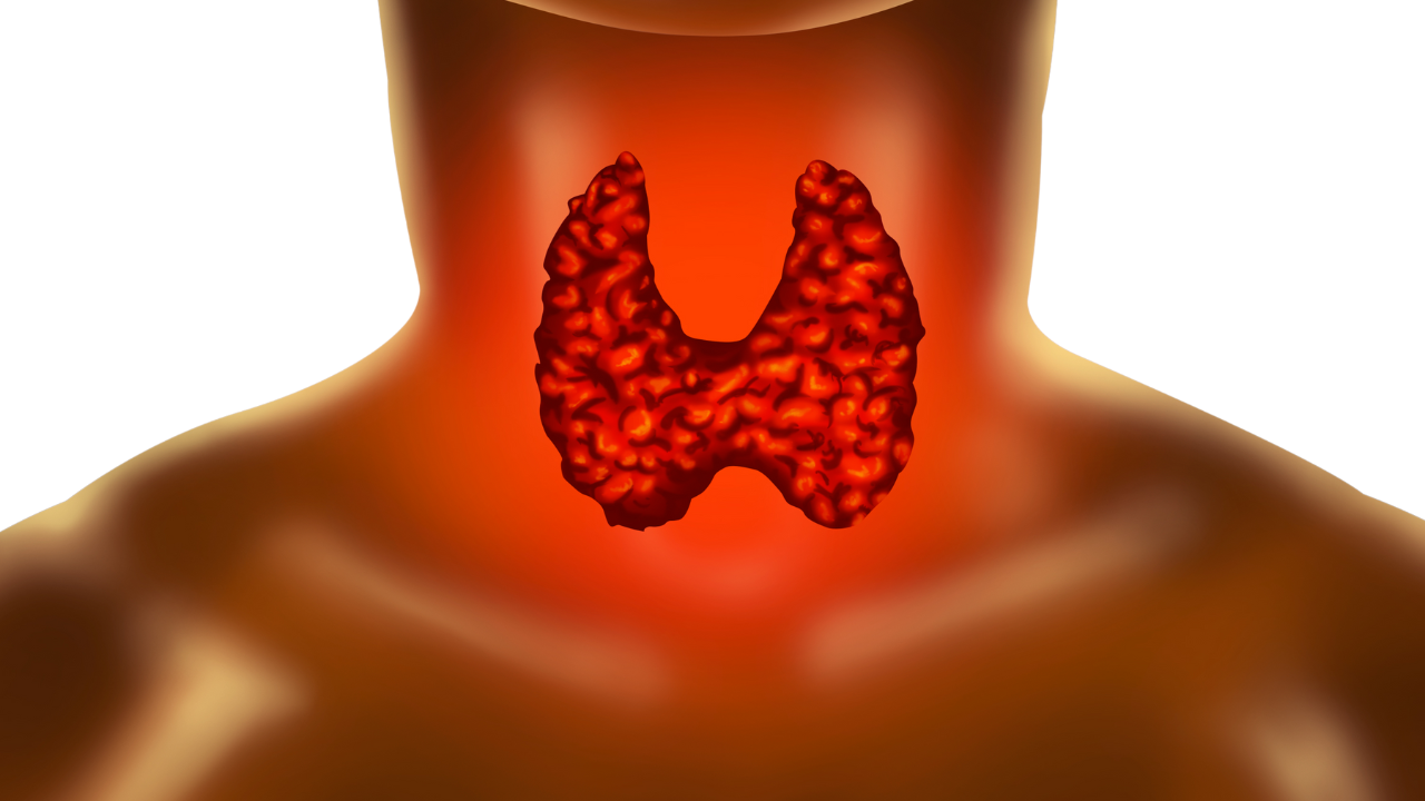 Hypothyroidism: An underactive thyroid gland. - Period Pain Clinic