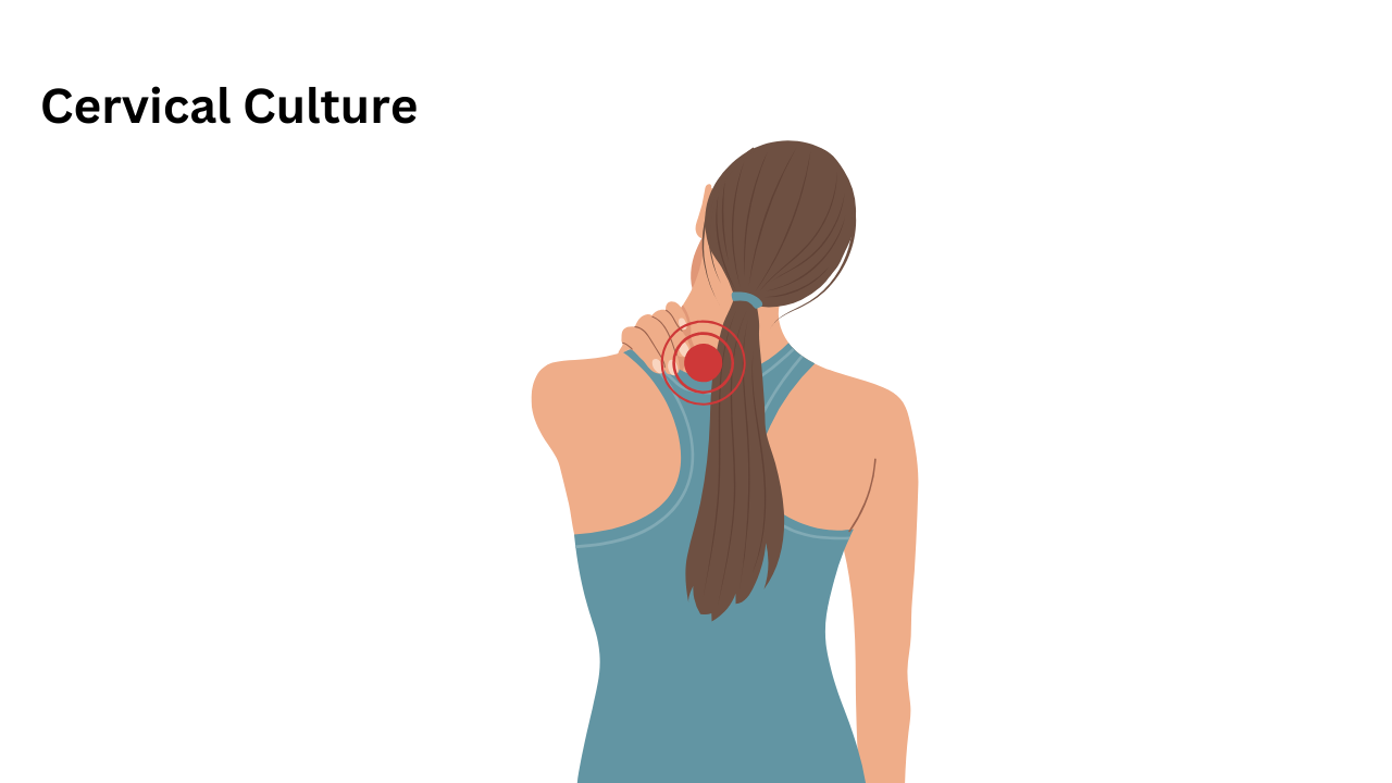 Cervical Culture: To check for sexually transmitted infections ...