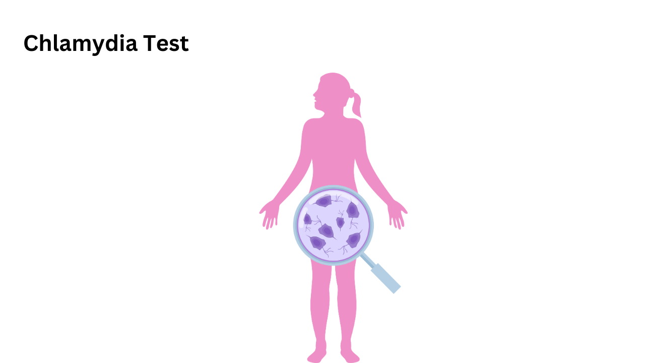 Chlamydia Test: To check for chlamydia infection. - Period Pain Clinic