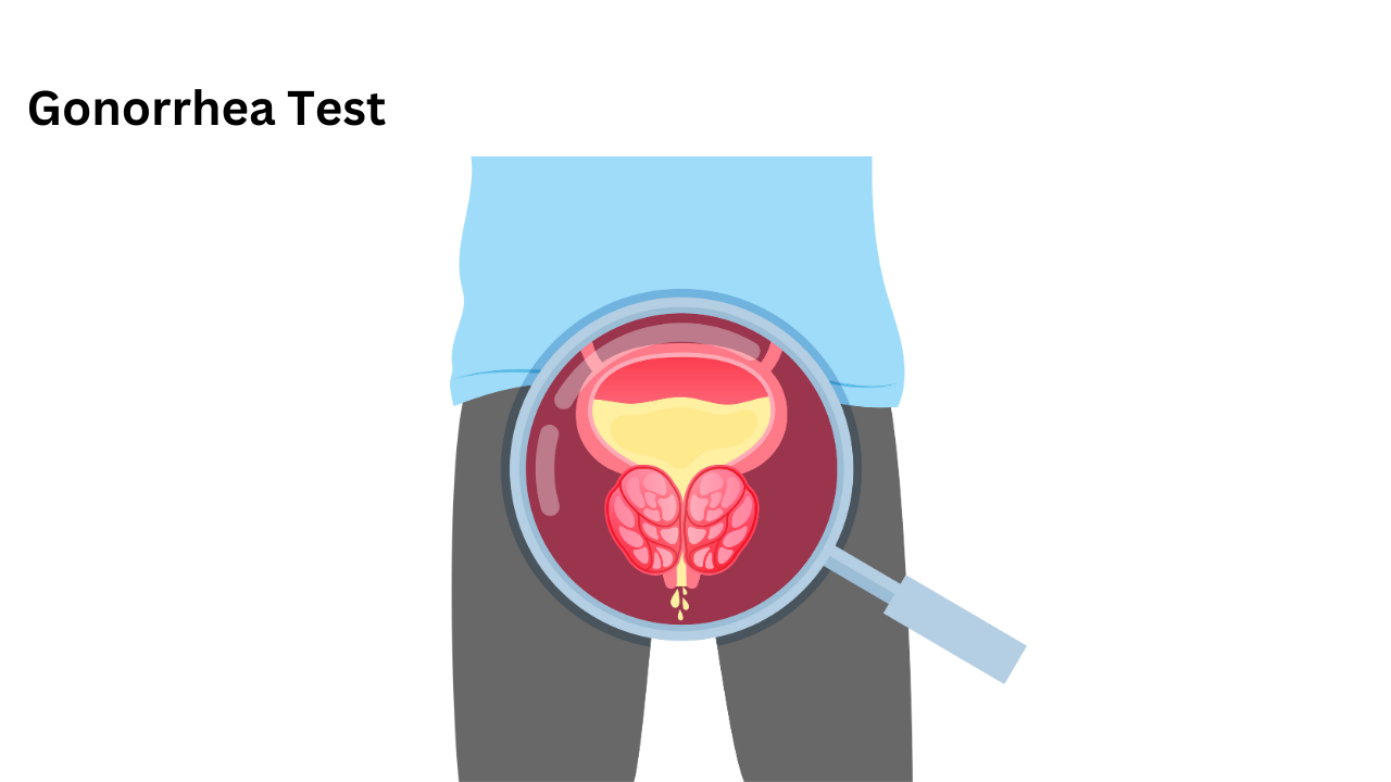 Gonorrhea Test: To check for gonorrhea infection. - Period Pain Clinic