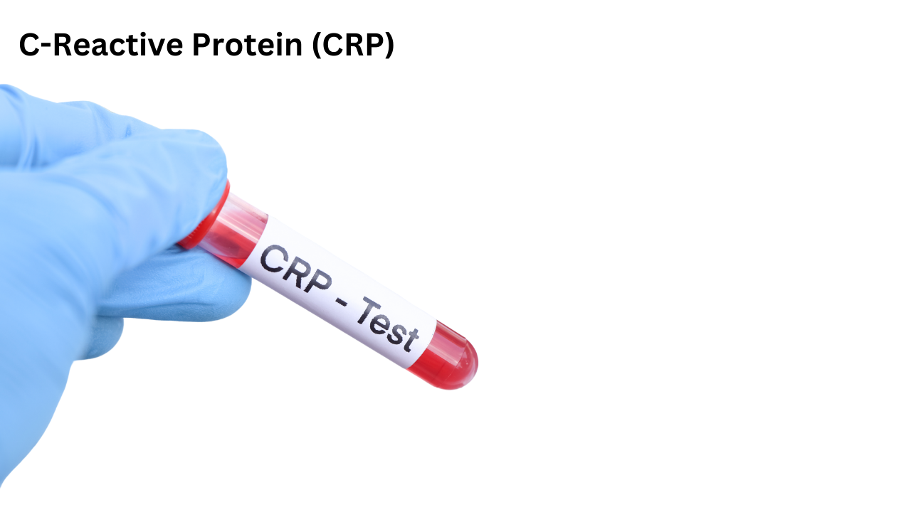 C-Reactive Protein (CRP): To check for inflammation. - Period Pain Clinic