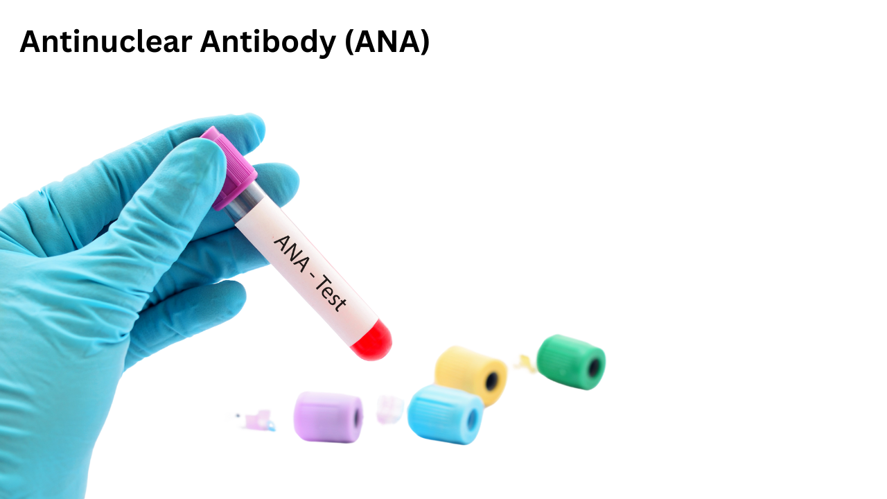 Antinuclear Antibody (ANA): To check for autoimmune diseases. - Period ...